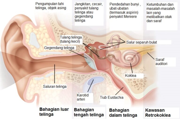 Kenapa Telinga Berdesing? Gejala, Punca, dan Rawatannya - eCanvas