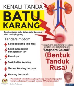 Ubat Batu Karang (Kidney Stones Medication), Pilihan Rawatan Untuk Anda ...